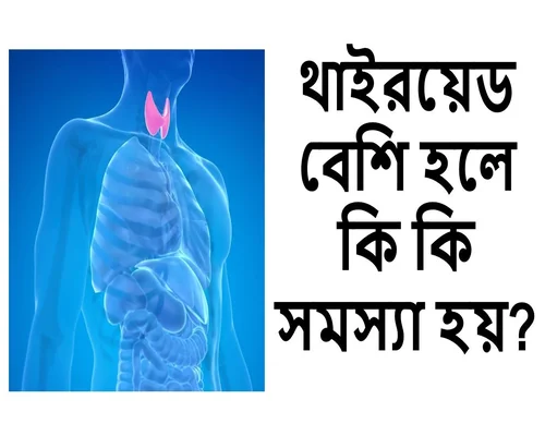 সফেদা ফলের উপকারিতা-sofeda foler upokarita